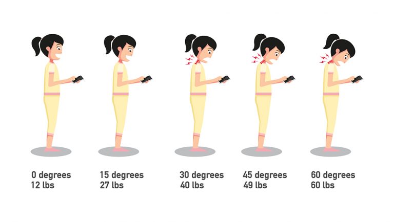 Upper Back Hump - Shakti Chiropractic